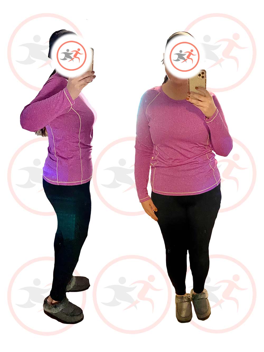 Before and After ESG procedure - 5months | Be Better Bariatrics