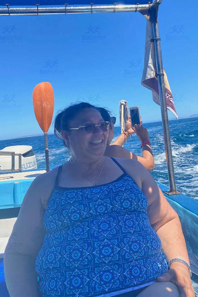 Before and After ESG procedure - 2 months | Be Better Bariatrics