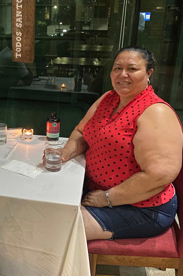 Before and After ESG procedure - 2 months | Be Better Bariatrics