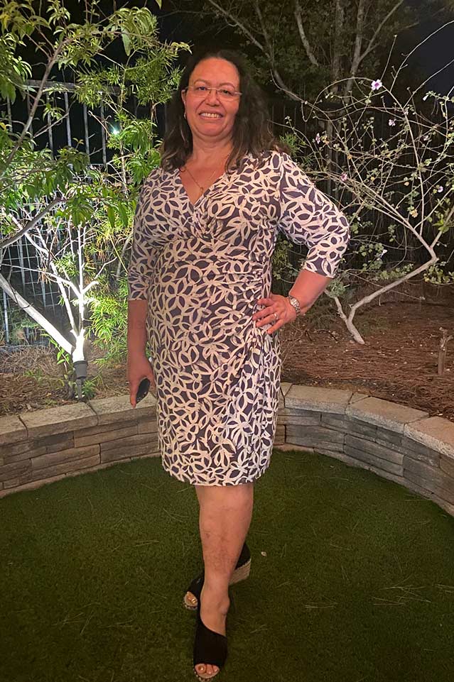 Before and After ESG procedure - 2 months | Be Better Bariatrics